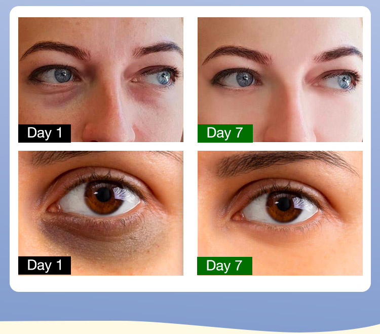 1099 get 2 tubes eye cream- ELLEN ELLA Morning & Night Eye Cream ...