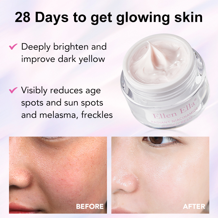Ellen Ella Radiant Niacinamide Serum Cream-Contains 75% rose essence ...