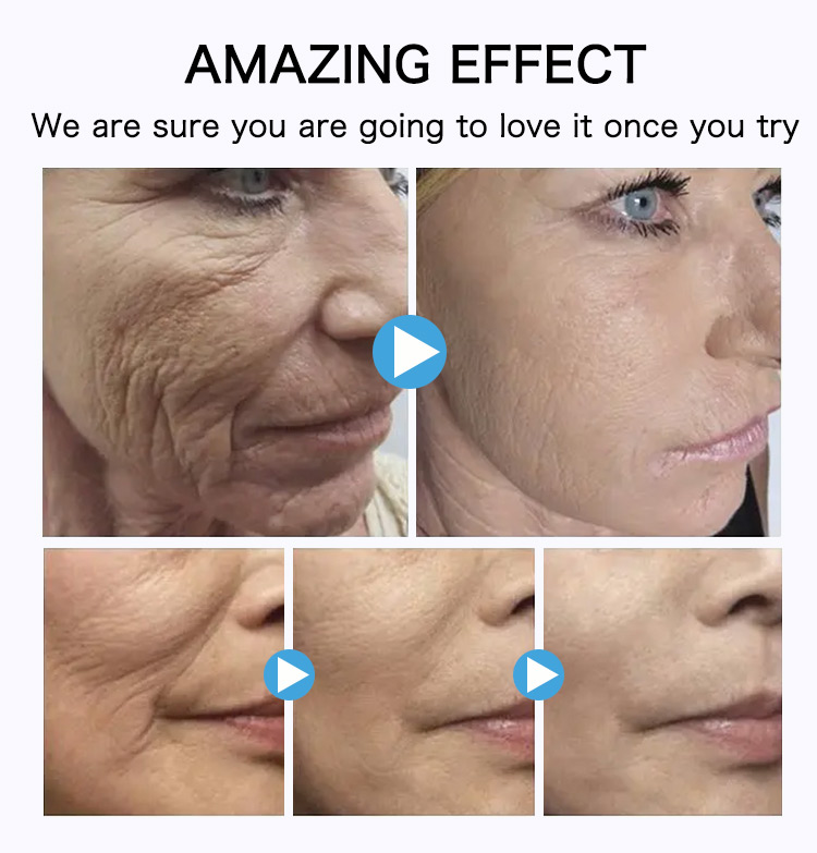 8-3 Women Day Promo-Upgrade Ellen Ella Retinol Face Cream-Effect ...