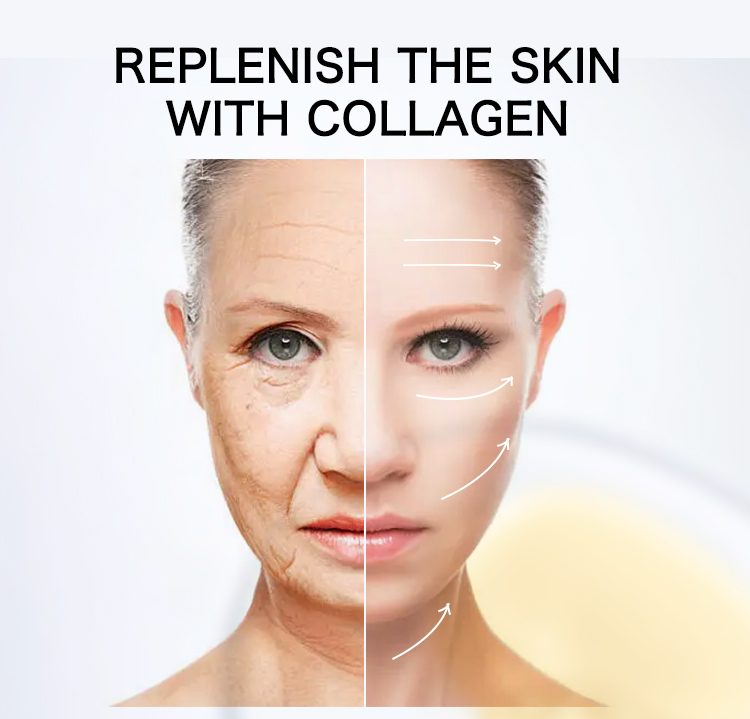 Buy 1 get 3 free - Upgrade Ellen Ella Retinol Face Cream - Effect ...