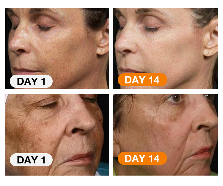 Buy 1 get 3 free - Upgrade Ellen Ella Retinol Face Cream - Effect ...