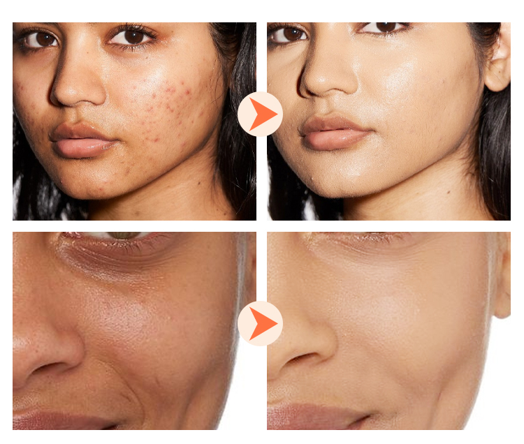 ELLEN ELLA Upgraded scientific skin care kit