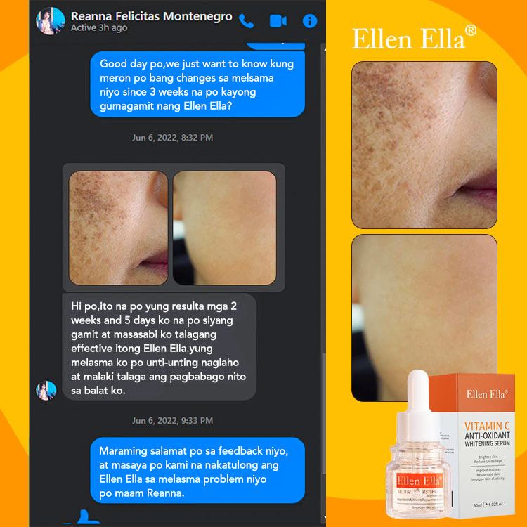 Ellen Ella Whitening Glow Serum buy one take one - Get Brighter Skin in 4 Weeks - Fades freckles ...